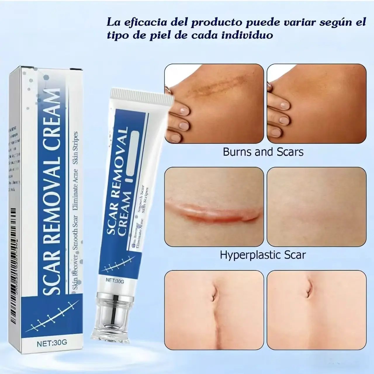 Professional Scar Removal Cream, AdvancedSilicone Skin Repair Gel for ...