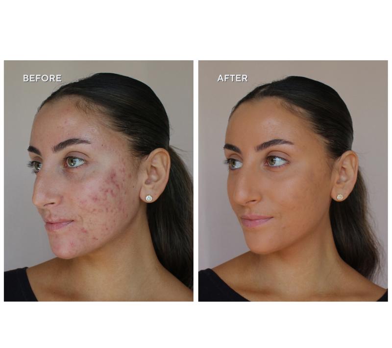 Doll 10 TCE Liquid Filter Foundation with Powder & Brush Concealer ...