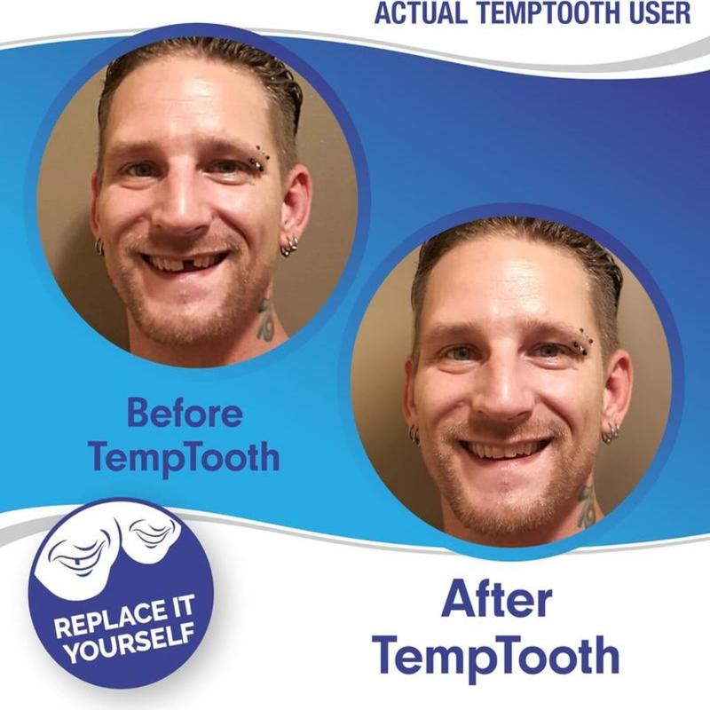 Temptooth - Do-It-Yourself Temporary Tooth Replacement Kit with Free ...