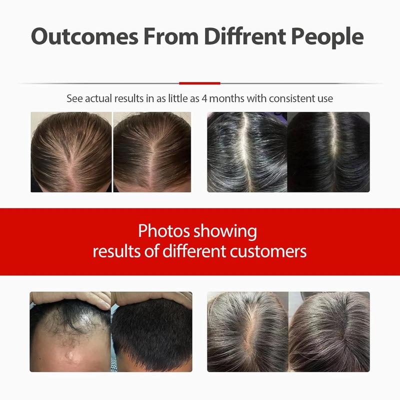 Red Light Therapy Cap for Hair Growth, 2026 Upgraded Laser Cap - TikTok ...