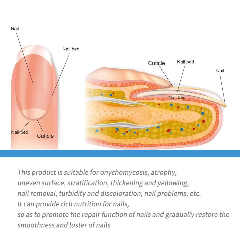 Nail Fungus Treatment – Triple-Action Repair for Brittle, Thick ...