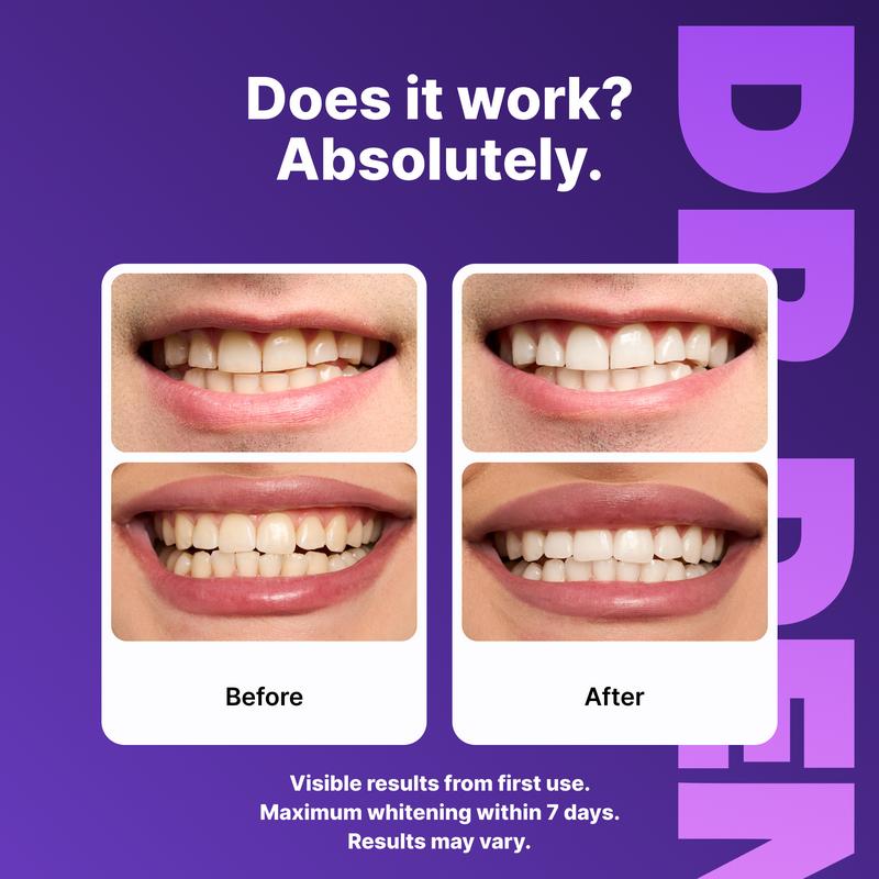 DRDENT Purple Teeth Whitening Strips - 7/21 Whitening Sessions - Safe ...